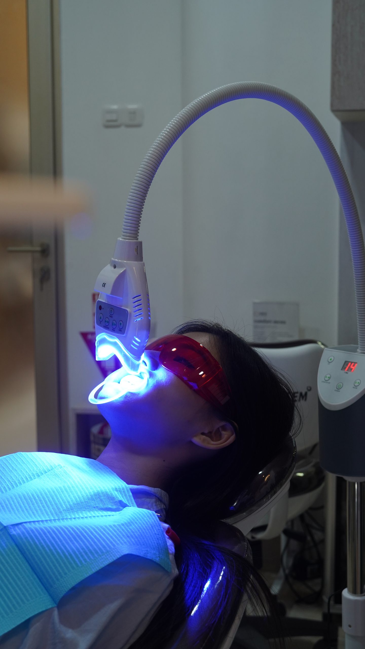 Bleaching Gigi: Prosedur, Manfaat, Risiko, dan Biaya - Neo Art Dental